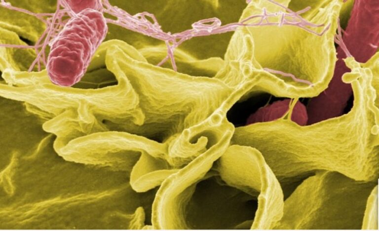 Lactoferrina: ¿Qué es, Cuál es su Función, Cuáles son Sus Propiedades ...